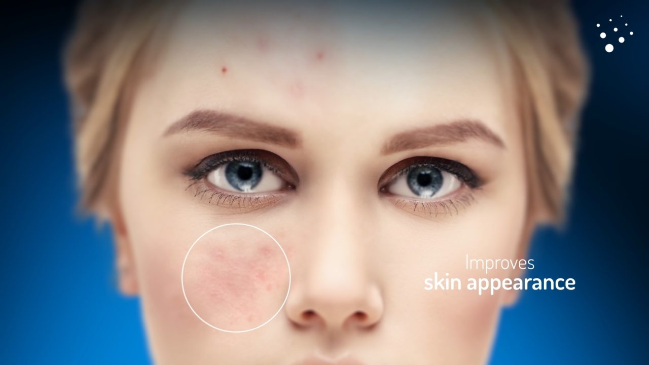 New laser system Dermablate® - ASCLEPION
