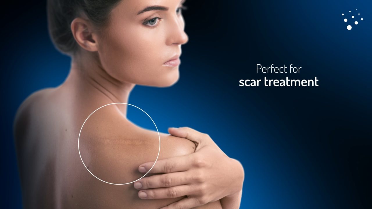 New laser system Dermablate® - ASCLEPION