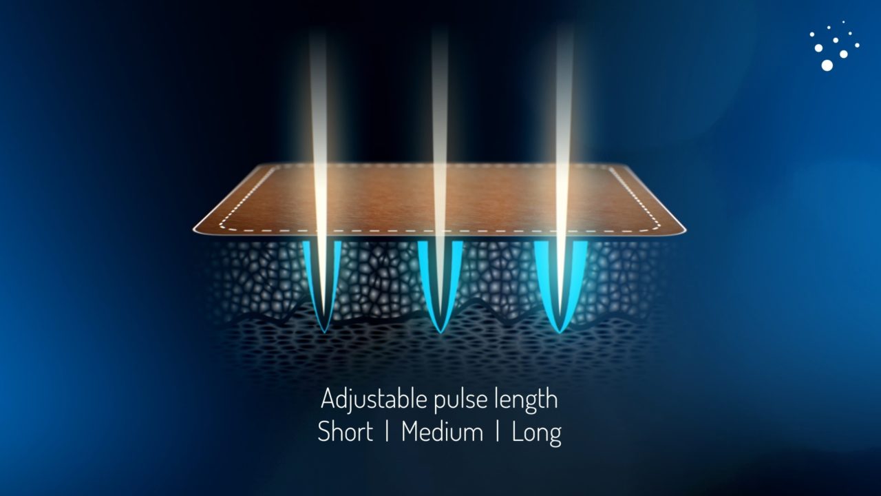 New laser system Dermablate® - ASCLEPION